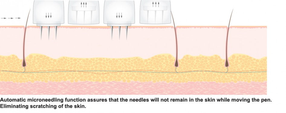 MTS Microneedling – Nu U Skinlab